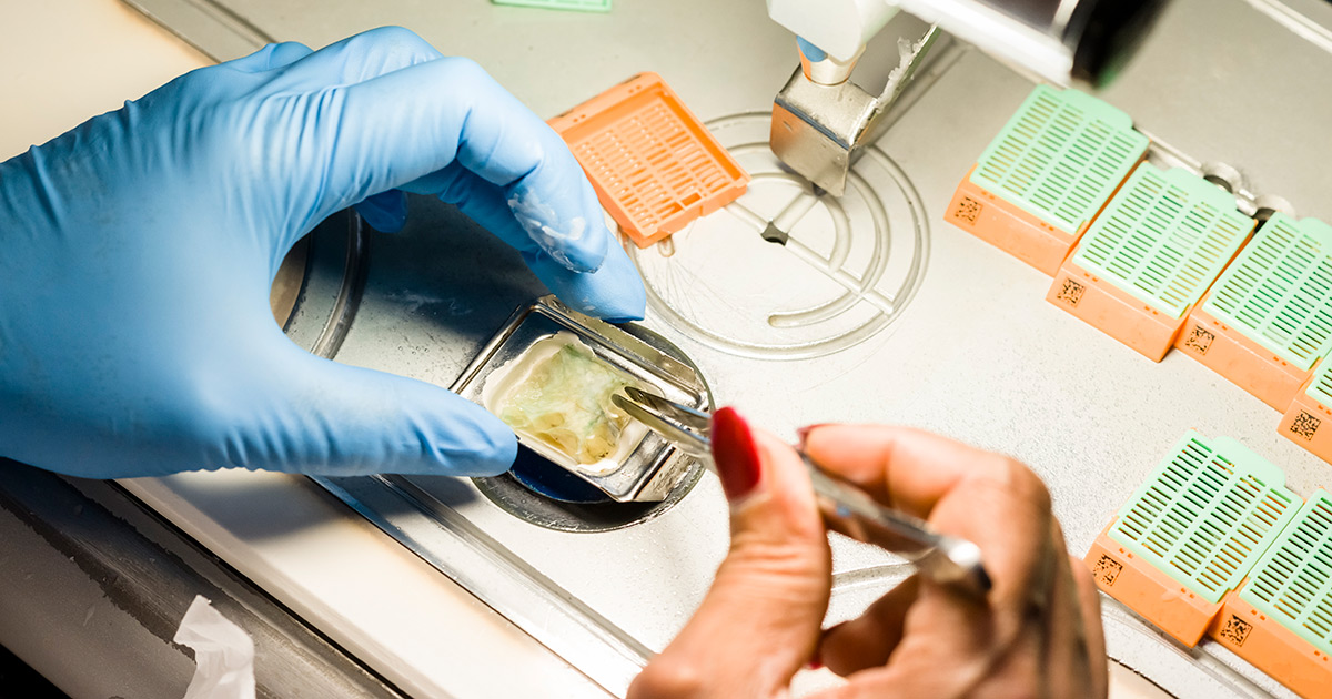 Behind the scenes How Tissue Samples Are Tested
