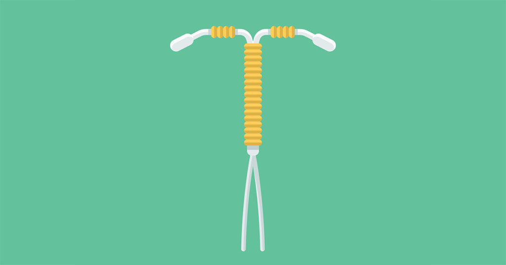 What you need to know about IUDs